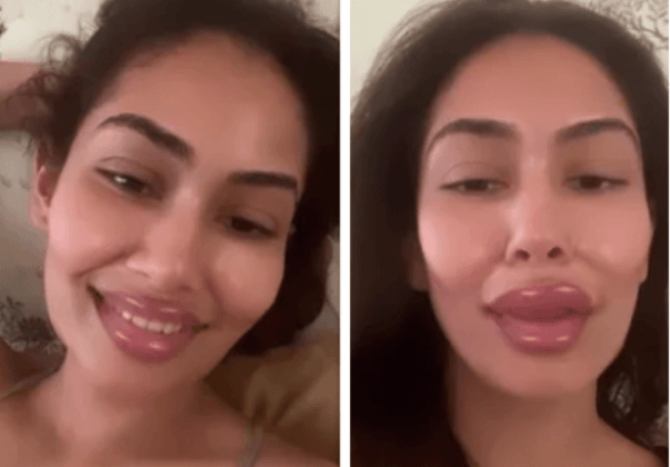 Mira Rajput shares new look with swollen lips and puffy cheeks ...