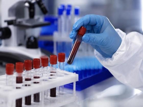 DGCA issues Ebola precaution SOP for airlines linked to Congo, Uganda ...